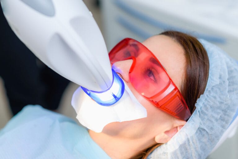 Laser Tooth Whitening Turkey - Teeth Whitening in Turkey